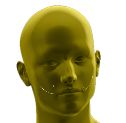 Dimple Creation Surgery (Dimpleplasty) in Mumbai